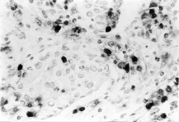 Anti-DNA Antibody, single stranded specific, clone F7-26 | MAB3299